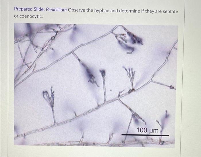 Solved Prepared Slide Penicillium Observe The Hyphae And