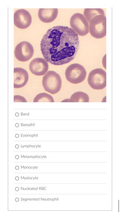 Solved Band Basophil Eosinophil Lymphocyte Metamyelocyte | Chegg.com