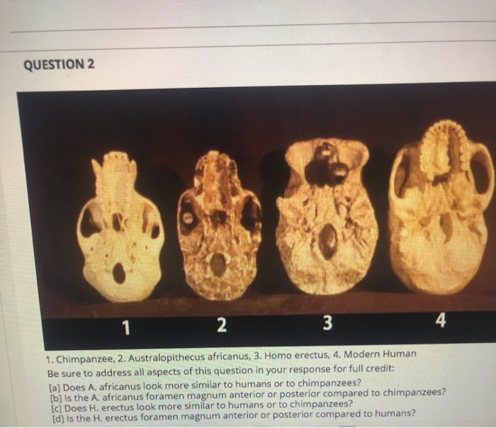 Solved QUESTION 1 Click on the foramen magnum. QUESTION 2 | Chegg.com