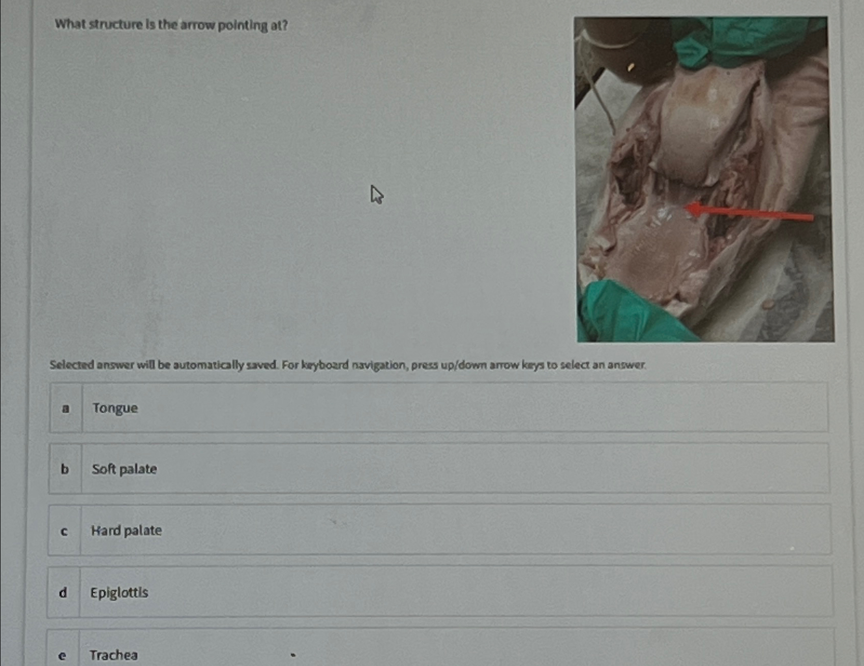 Solved What structure is the arrow pointing at?Selected | Chegg.com