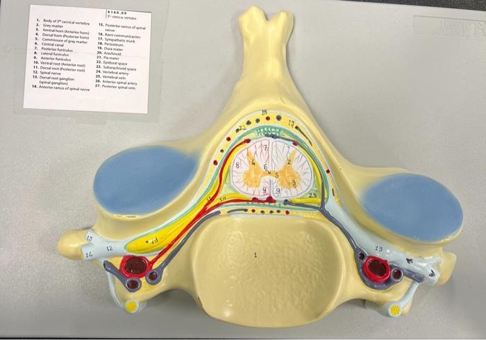 Solved 1. Body of 5n cervical vertebra 15. Posterior ramus | Chegg.com