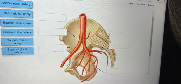 Solved Middle rectal artery Hels Inferior gluteal artery | Chegg.com