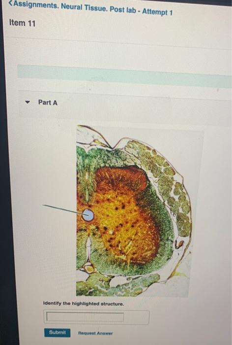 Solved 〈Assignments. Neural Tissue. Post lab - Attempt 1 | Chegg.com