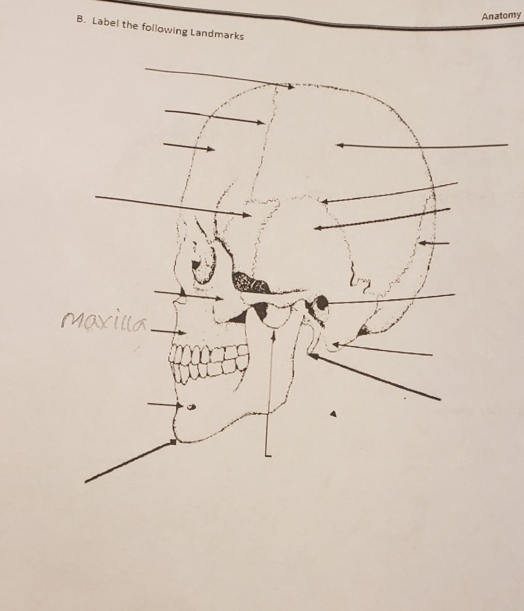 Solved B. Label the following Landmarks | Chegg.com