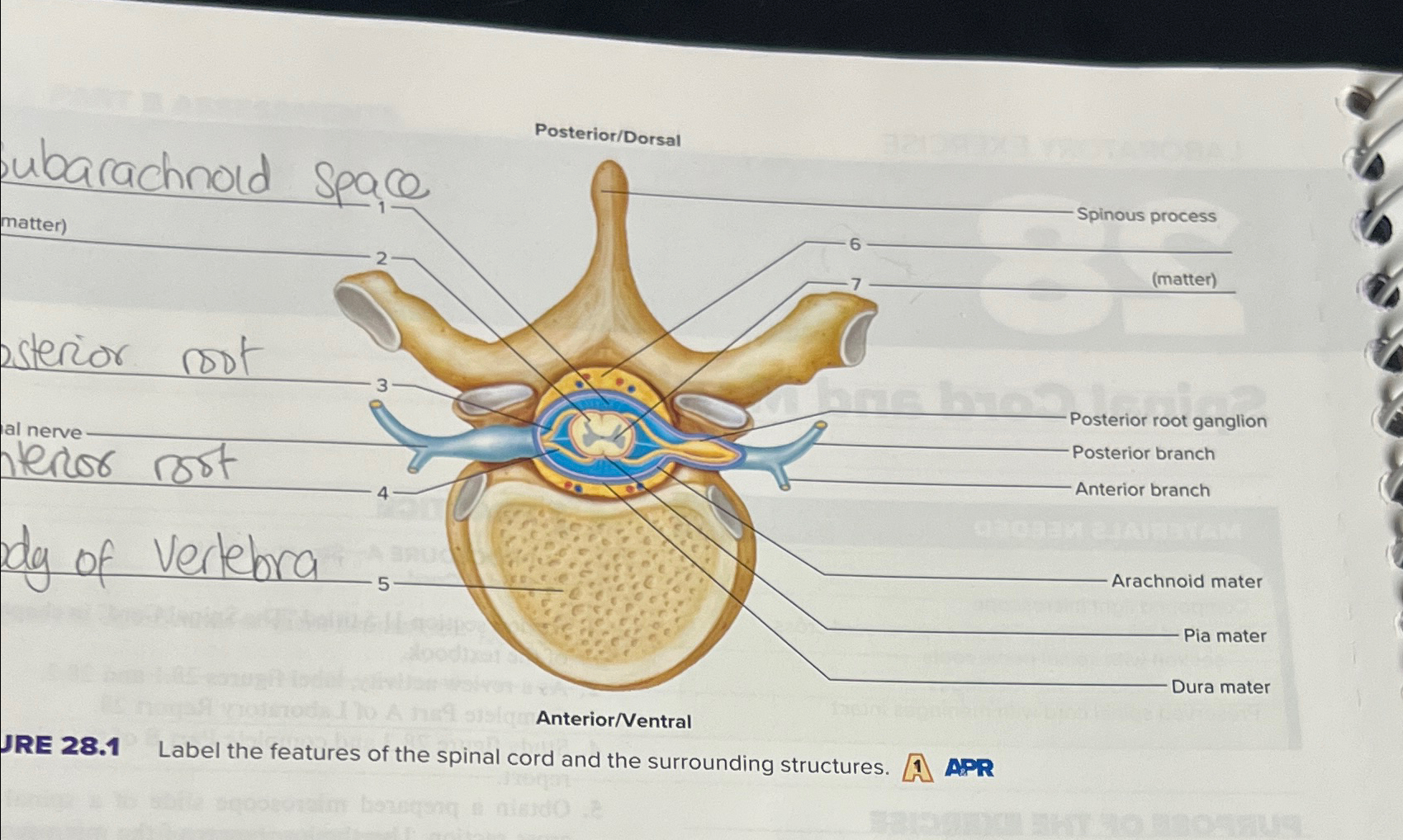 Solved Posterior/DorsalAnterior/VentralJRE 28.1 ﻿Label the | Chegg.com