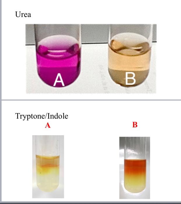 Solved Exercise 30 Results Starch Agar Plate с Casein Agar | Chegg.com