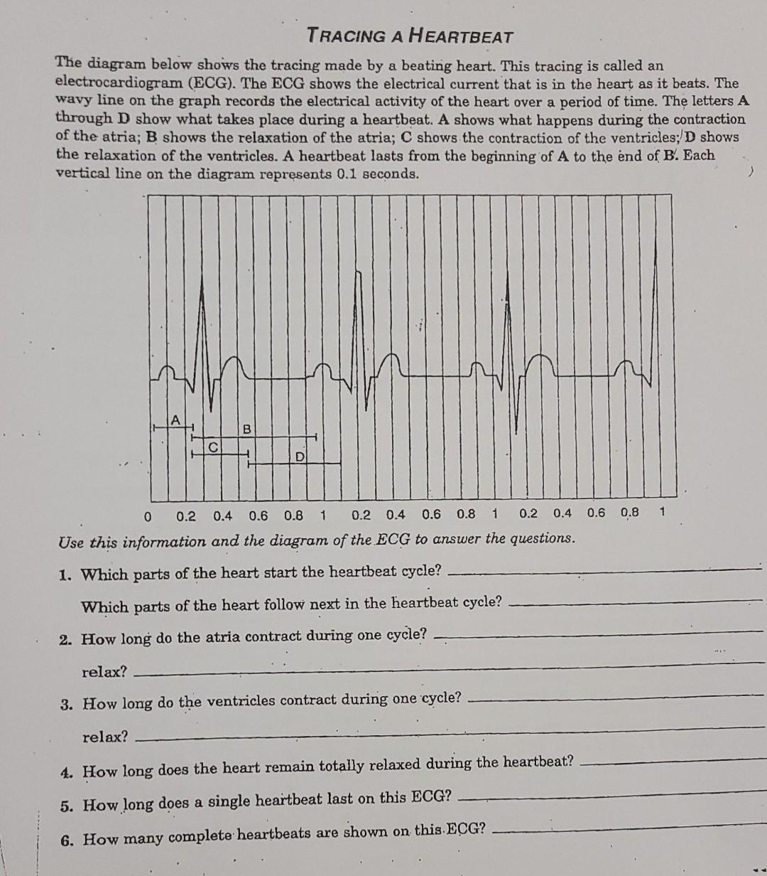 Solved TRACING A HEARTBEAT The diagram below shows the | Chegg.com