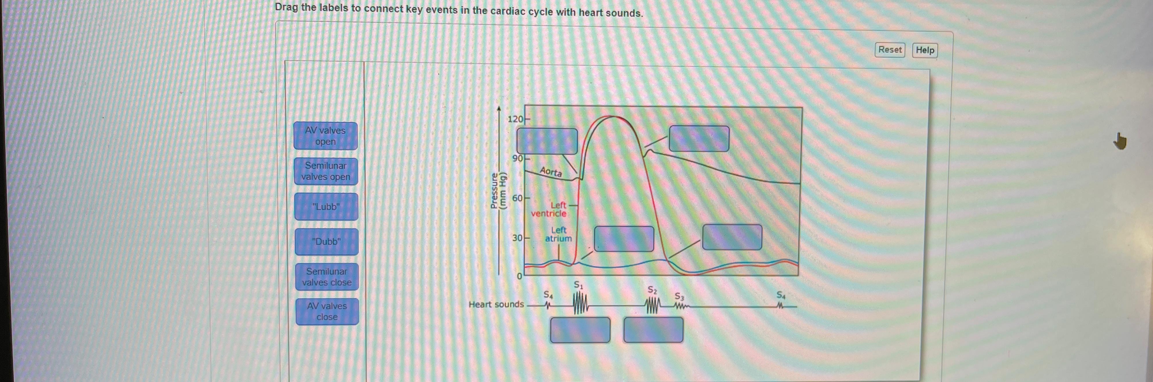Solved Drag the labels to connect key events in the cardiac | Chegg.com