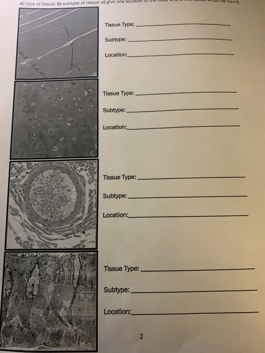 Solved be found. a) type of tissue; b) subtype of tissue; c) | Chegg.com