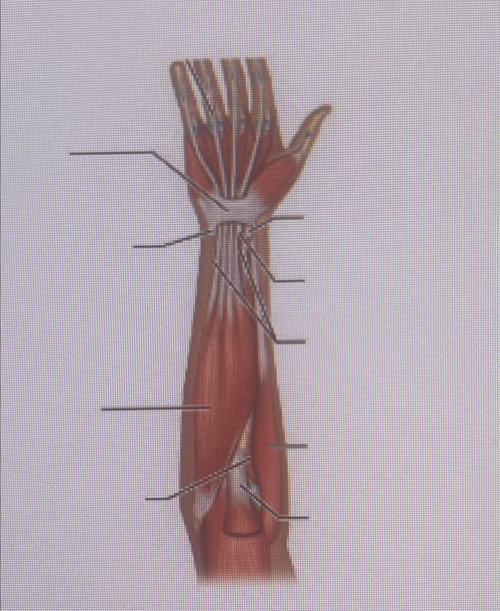Solved HELP!! Part 2 Label All Muscles | Chegg.com Solved HELP!! Part 2 Label All Muscles | Chegg.com