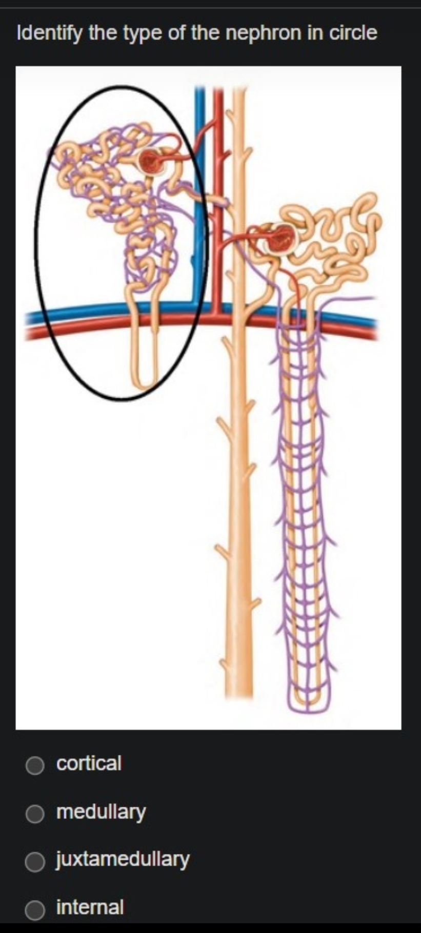 Solved Identify the type of the nephron in | Chegg.com