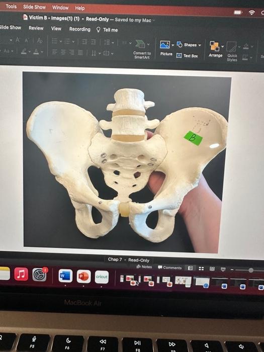 Solved DEM Bones: Forensic Resurrection of a Skeleton | Chegg.com