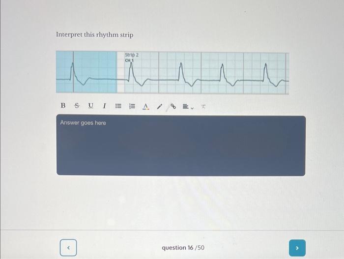 Interpret this rhythm strip Interpret this rhythm | Chegg.com