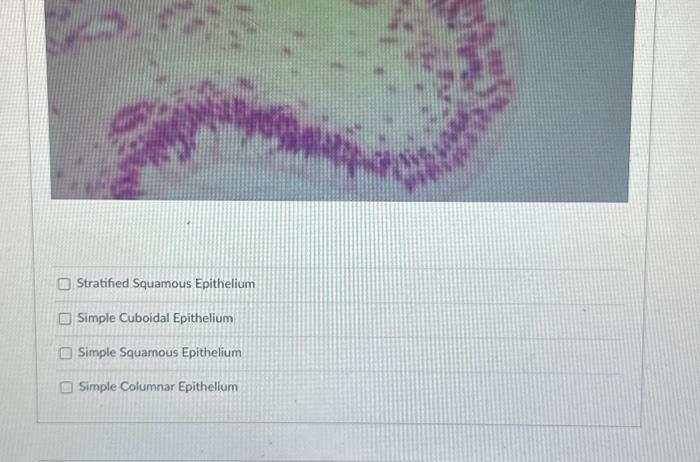 Solved Identify this tissue type: Stratified Squamous | Chegg.com
