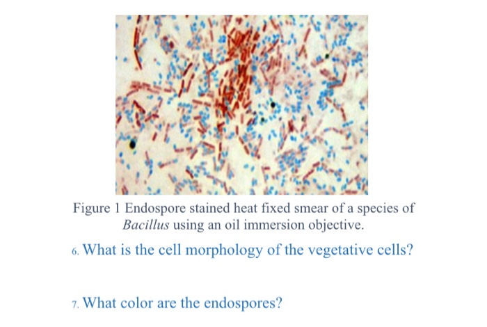 Solved Figure 1 Endospore stained heat fixed smear of a | Chegg.com