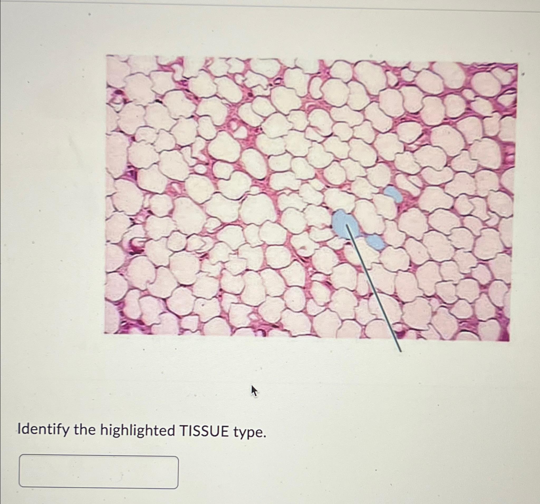 Solved Identify the highlighted TISSUE type. | Chegg.com