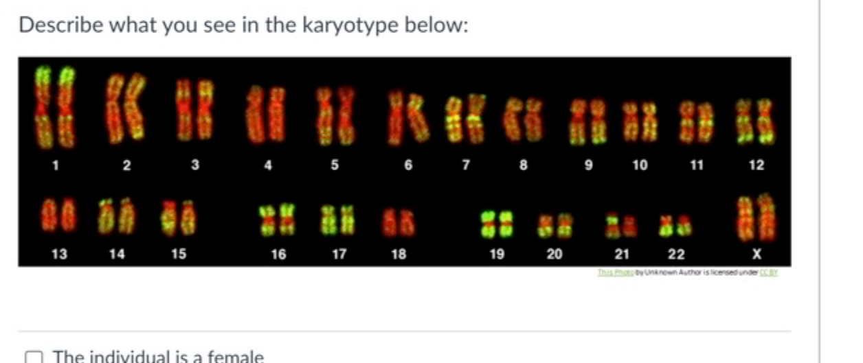 Solved Describe what you see in the karyotype below: | Chegg.com