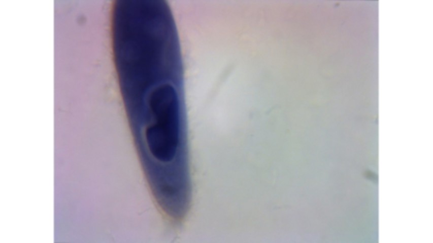 Solved Label the cilia, oral groove, and nucleus | Chegg.com