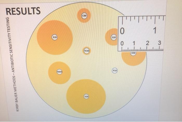 Solved Results: Table 1. Zone Size Interpretation Chart and | Chegg.com