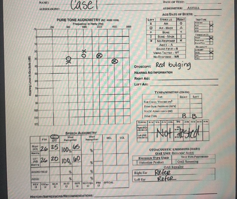 Solved Using the attachment below, explain Max's Audiometric | Chegg.com Solved Using the attachment below, explain Max's Audiometric | Chegg.com