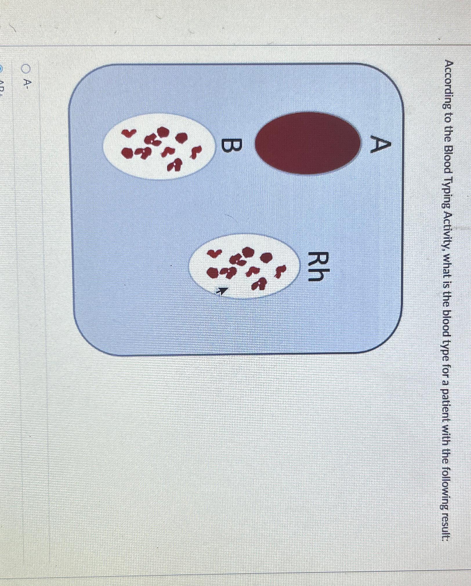 According to the Blood Typing Activity, what is the | Chegg.com