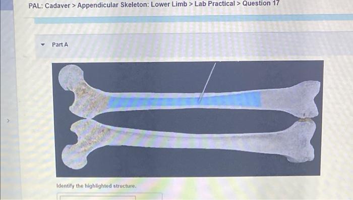 Solved PAL: Cadaver > Appendicular Skeleton: Pelvic Girdle > | Chegg.com