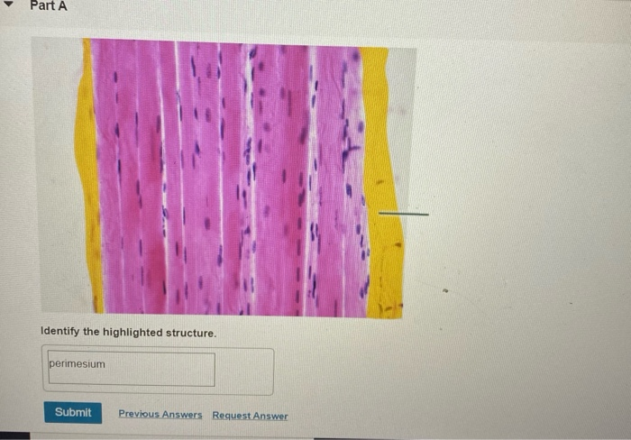 Solved Part A Identify the highlighted structure. perimesium | Chegg.com