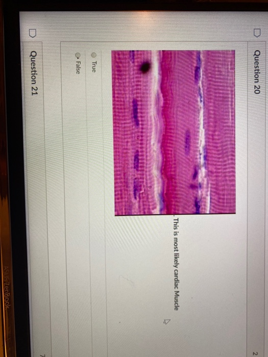 Solved The two epitheliums in this slide: Human Histolon | Chegg.com