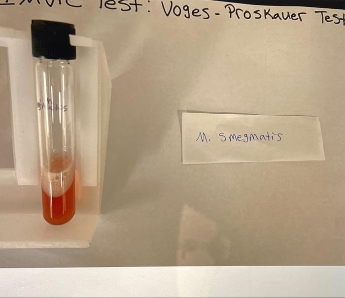 Solved PART B: Methyl Red Test and Voges-Proskauer Test | Chegg.com