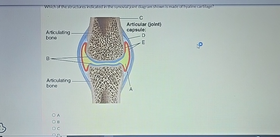 Solved Which of the structures indicated in the synovial | Chegg.com