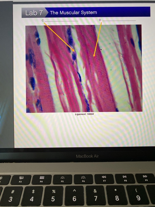 Solved Lab 7 The Muscular System С D Ligament: 1000x MacBook | Chegg.com