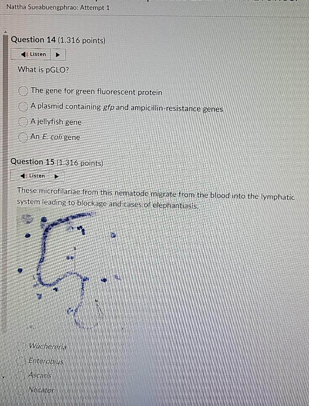 Solved Interpret the results of the Ornithine decarboxylase | Chegg.com