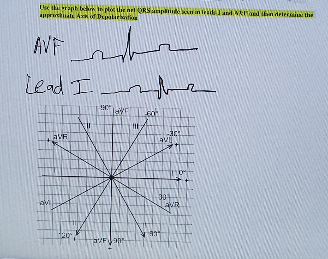 Solved Use the graph below to plot the net QRS amplitude | Chegg.com