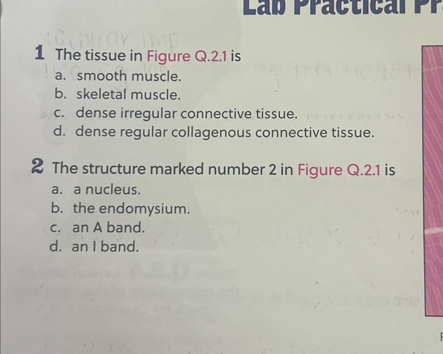 Solved 1 ﻿The tissue in Figure Q.2.1 ﻿isa. ﻿smooth muscle.b. | Chegg.com