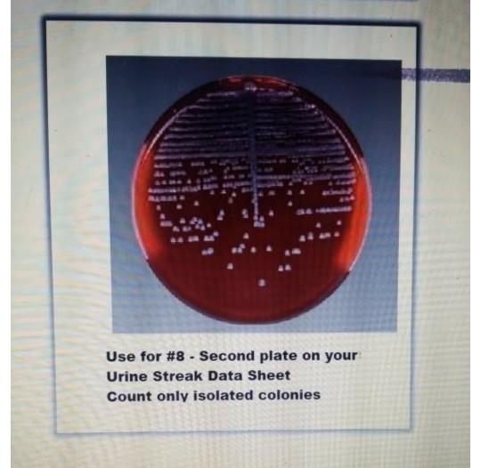 Solved 6-3 Urine Culture OBSERVATIONS AND INTERPRETATIONS 1 | Chegg.com