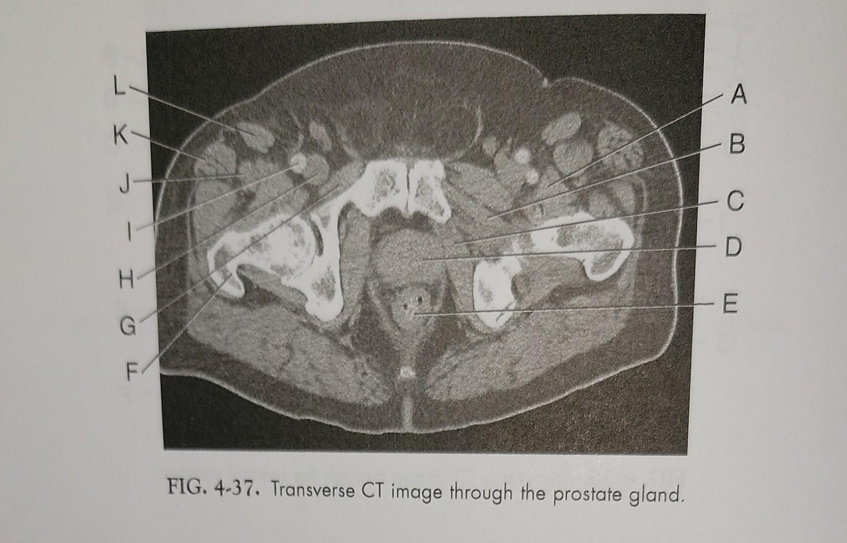 Solved FIG. 4-32. Transverse CT image through the | Chegg.com