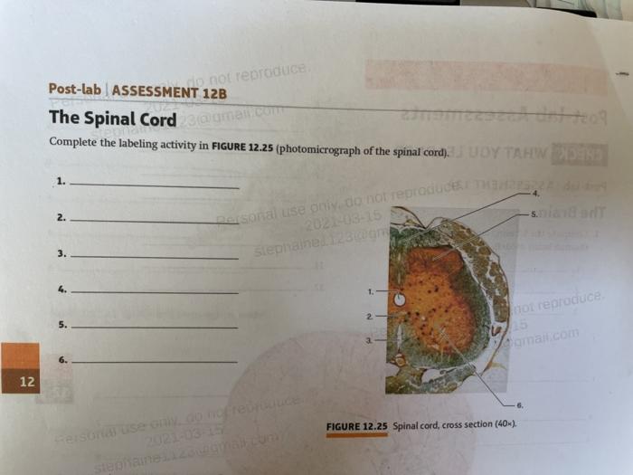 Solved o not reproduce Post-lab ASSESSMENT 12B The Spinal | Chegg.com