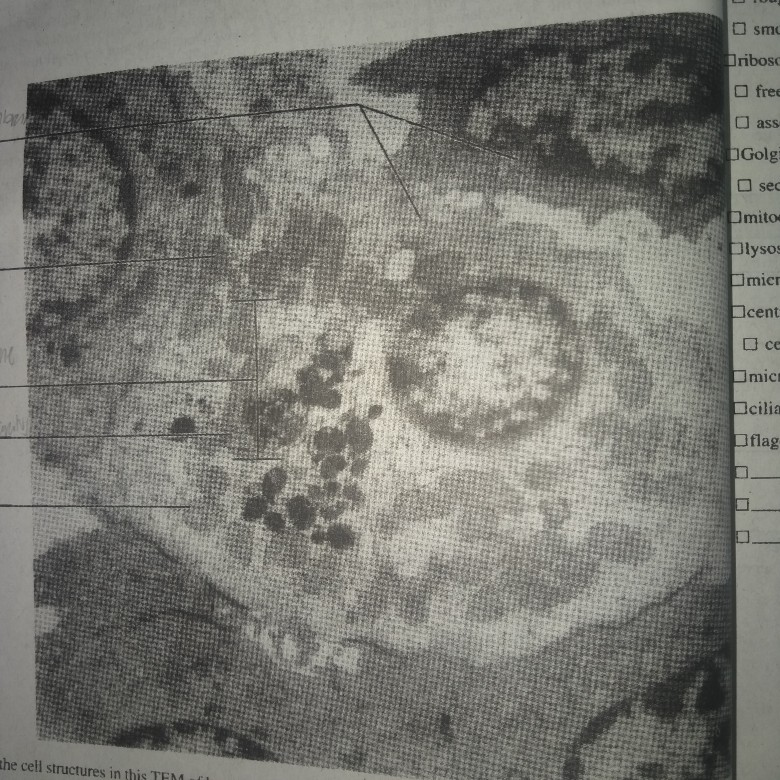 Solved Identify the cell structures in this tem of human | Chegg.com