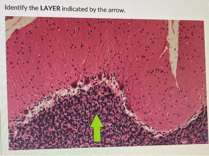 Solved Identify the LAYER indicated by the arrow. | Chegg.com
