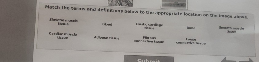 Solved Practice: Types of Tissue Match the terms and | Chegg.com