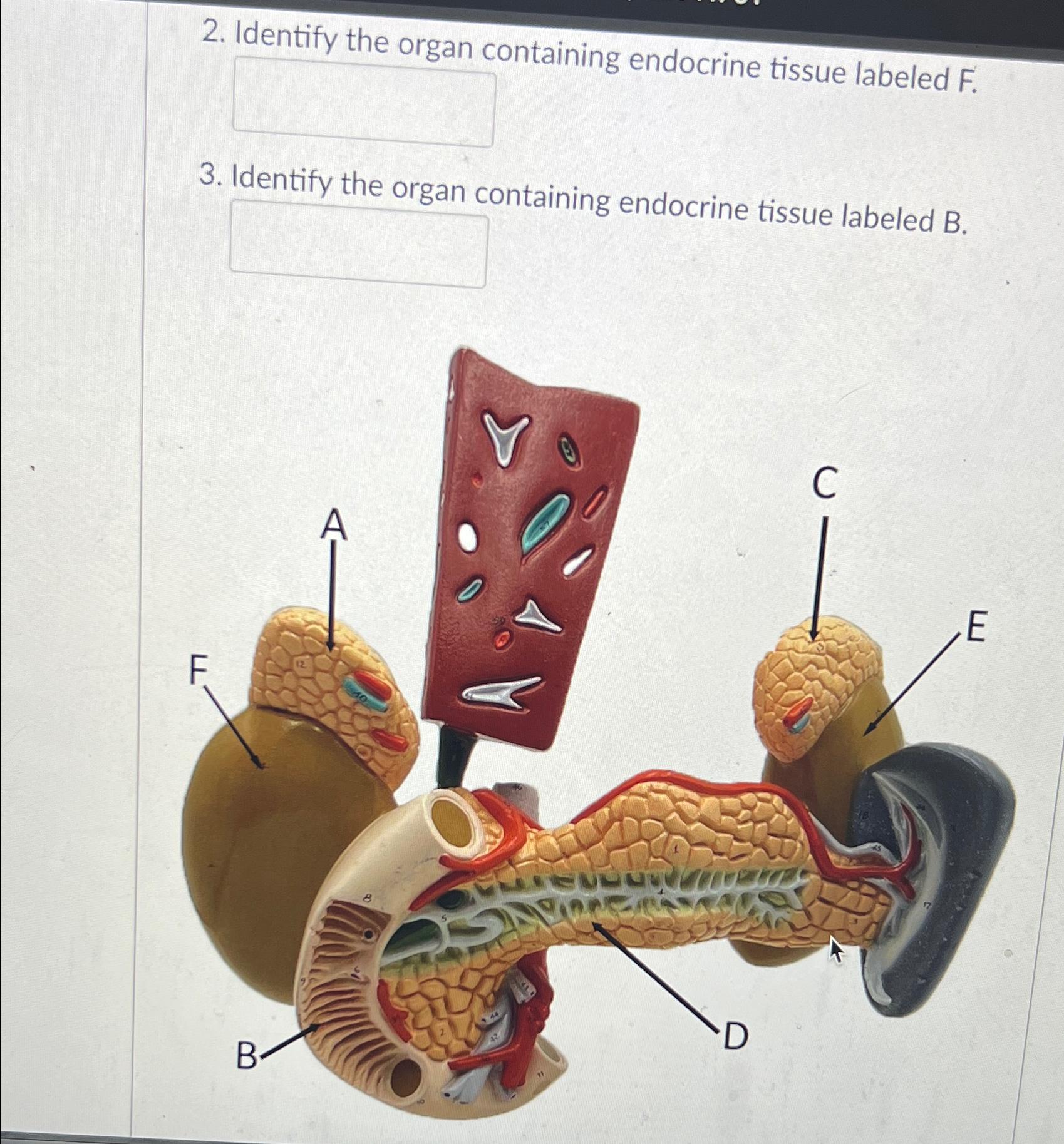 Solved Identify the organ containing endocrine tissue | Chegg.com