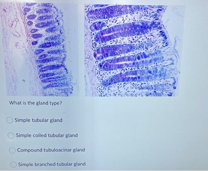 Solved What is the gland type? Simple tubular gland Simple | Chegg.com