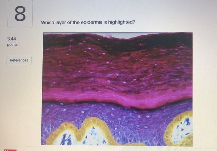 Solved 00 Which layer of the epidermis is highlighted? 3.44 | Chegg.com