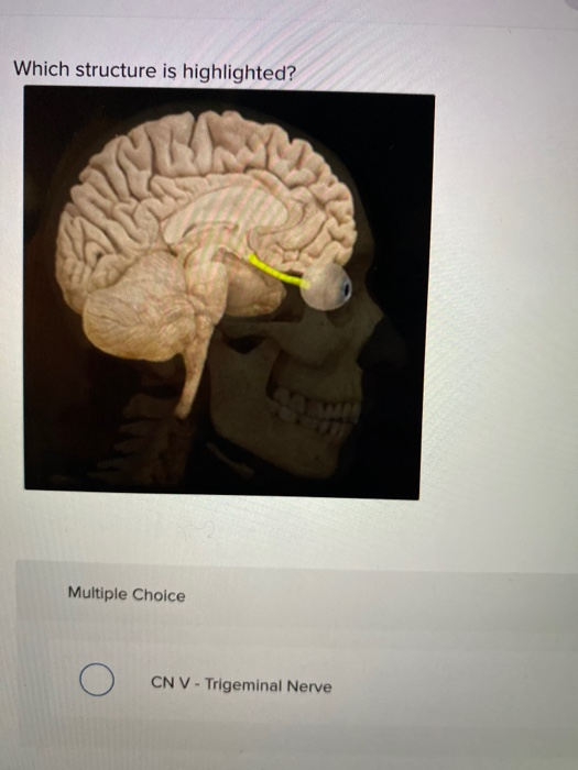 Solved Which structure is highlighted? Multiple Choice CNV - | Chegg.com