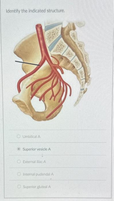 Solved Identify the indicated structure. UimbicaliA Superior | Chegg.com