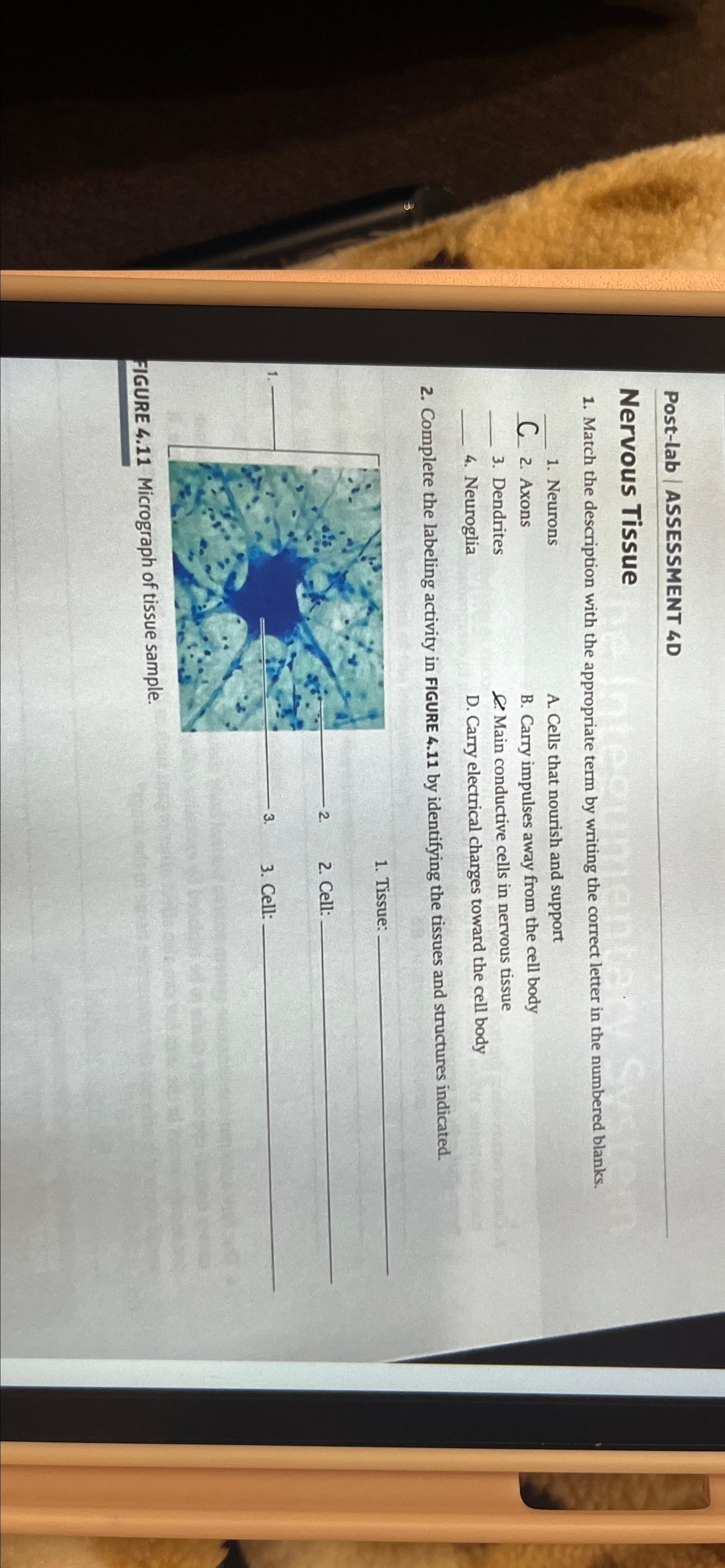 Solved Post-lab | ﻿ASSESSMENT 4DNervous TissueMatch the | Chegg.com