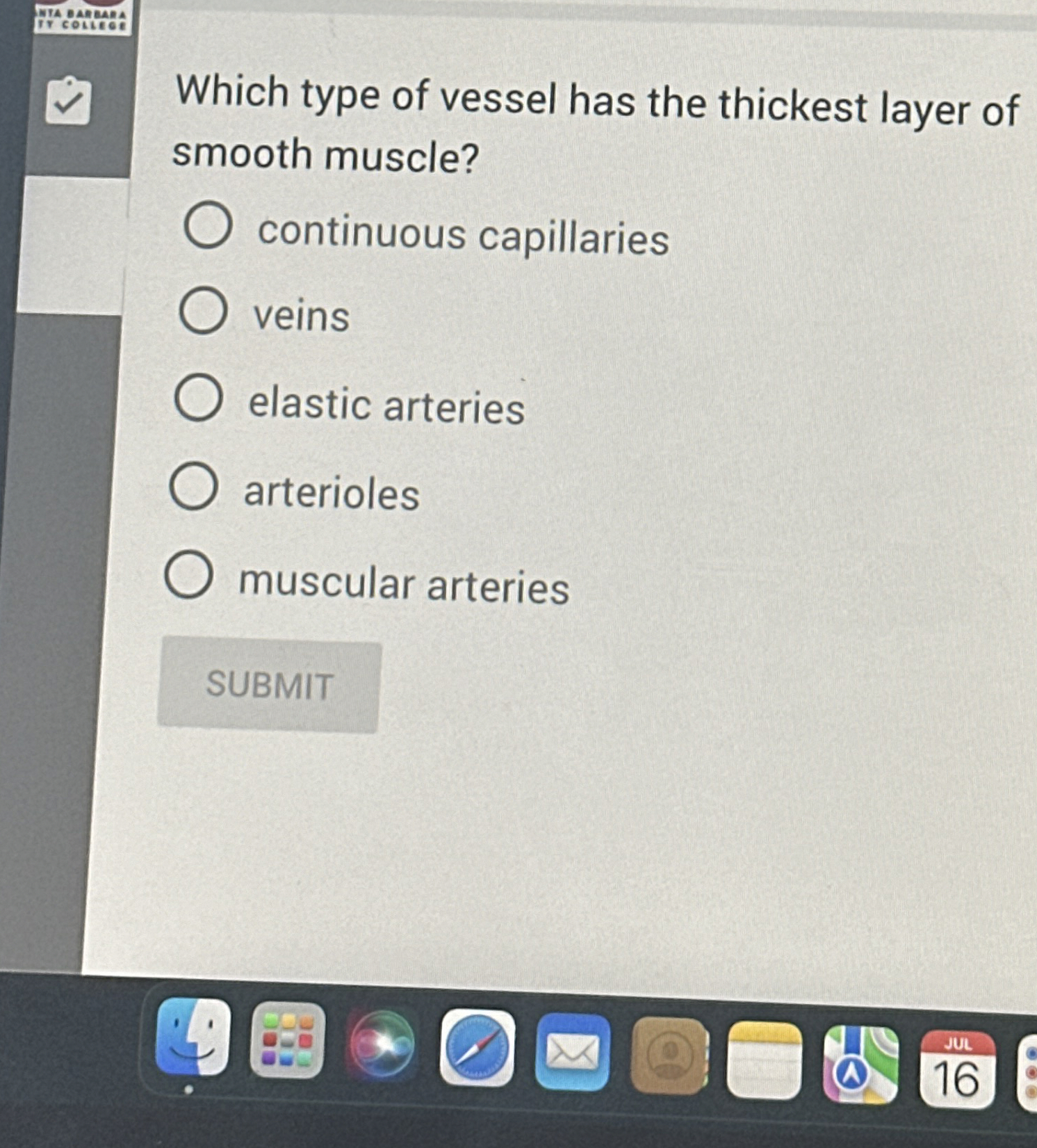 Solved TI cotus:Which type of vessel has the thickest layer | Chegg.com
