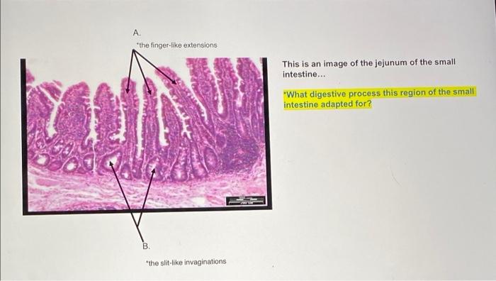 Solved A the finger-like extensions This is an image of the | Chegg.com