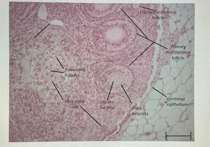 Solved Please label all of the visible structures in the | Chegg.com