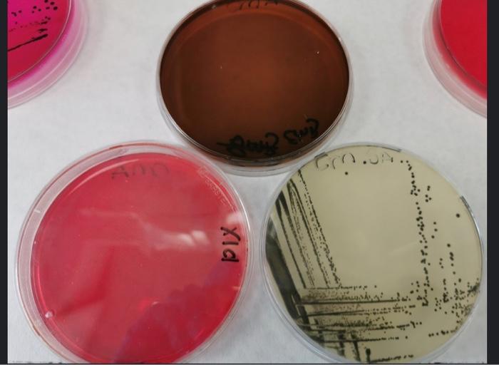 Solved Identify an unknown pathogen from a given enrichment | Chegg.com